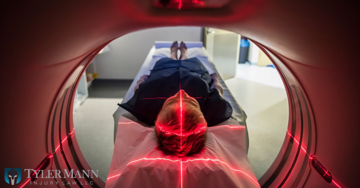 TBI Cases: What Are They and How Do You Prove One